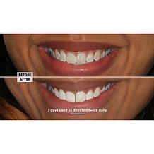 intelliWHiTE | Shop Teeth Whitening Kits, Toothpaste & Toothbrushes | HSN