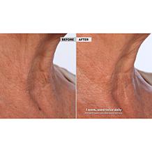 Korres Skin Care Products | HSN