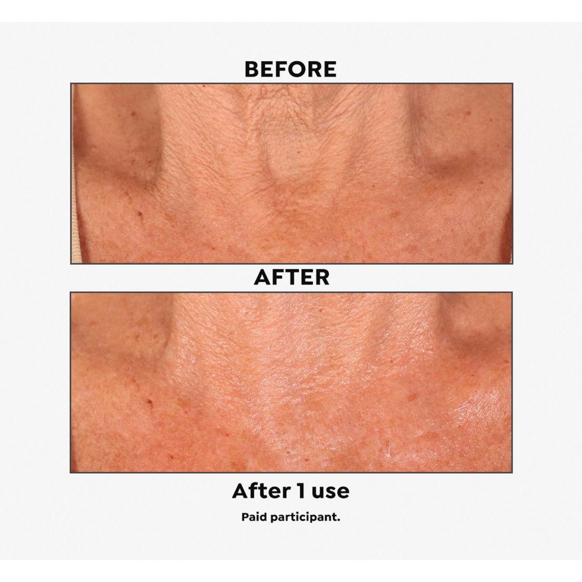 (HSN) Nakery Beauty Smooth + Restore Skin Renewal 4-pc Collection with ...